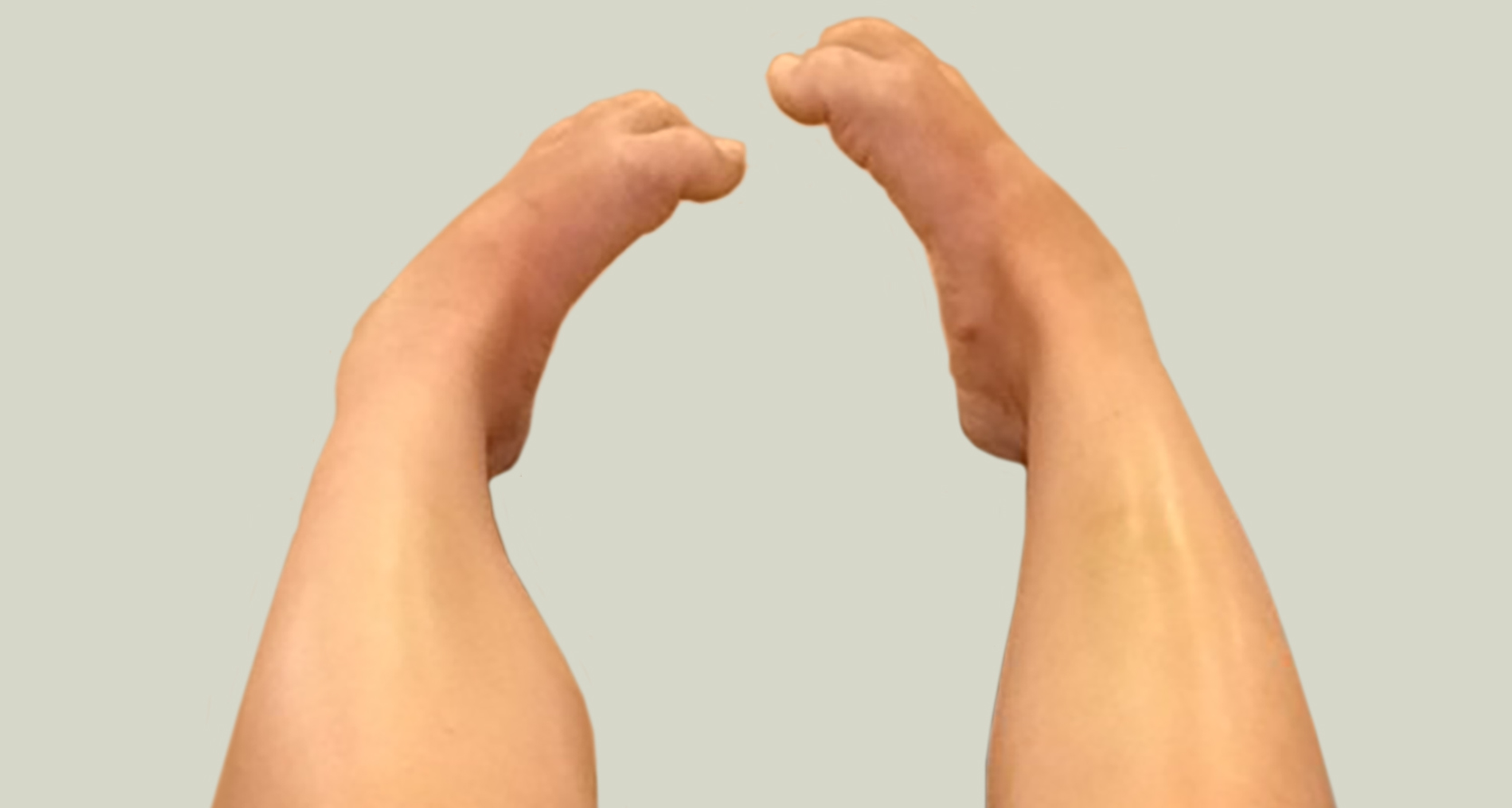 By Pain Site Injury Foot Jobskin 