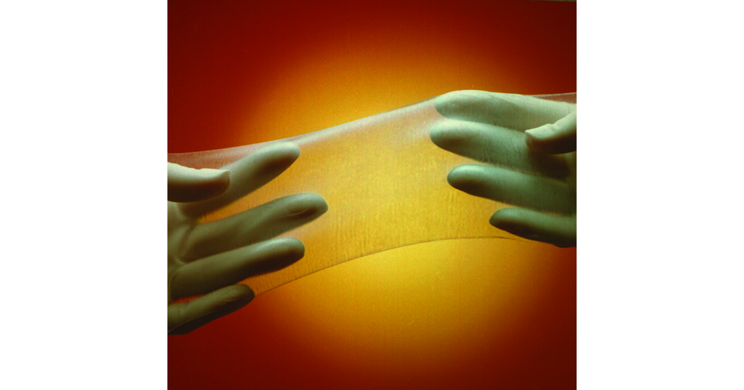 Research into New Burn-Care Technology